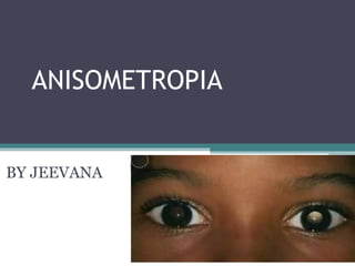 Anisometropia: Causes, Symptoms and Treatment of Unequal Refractive ...