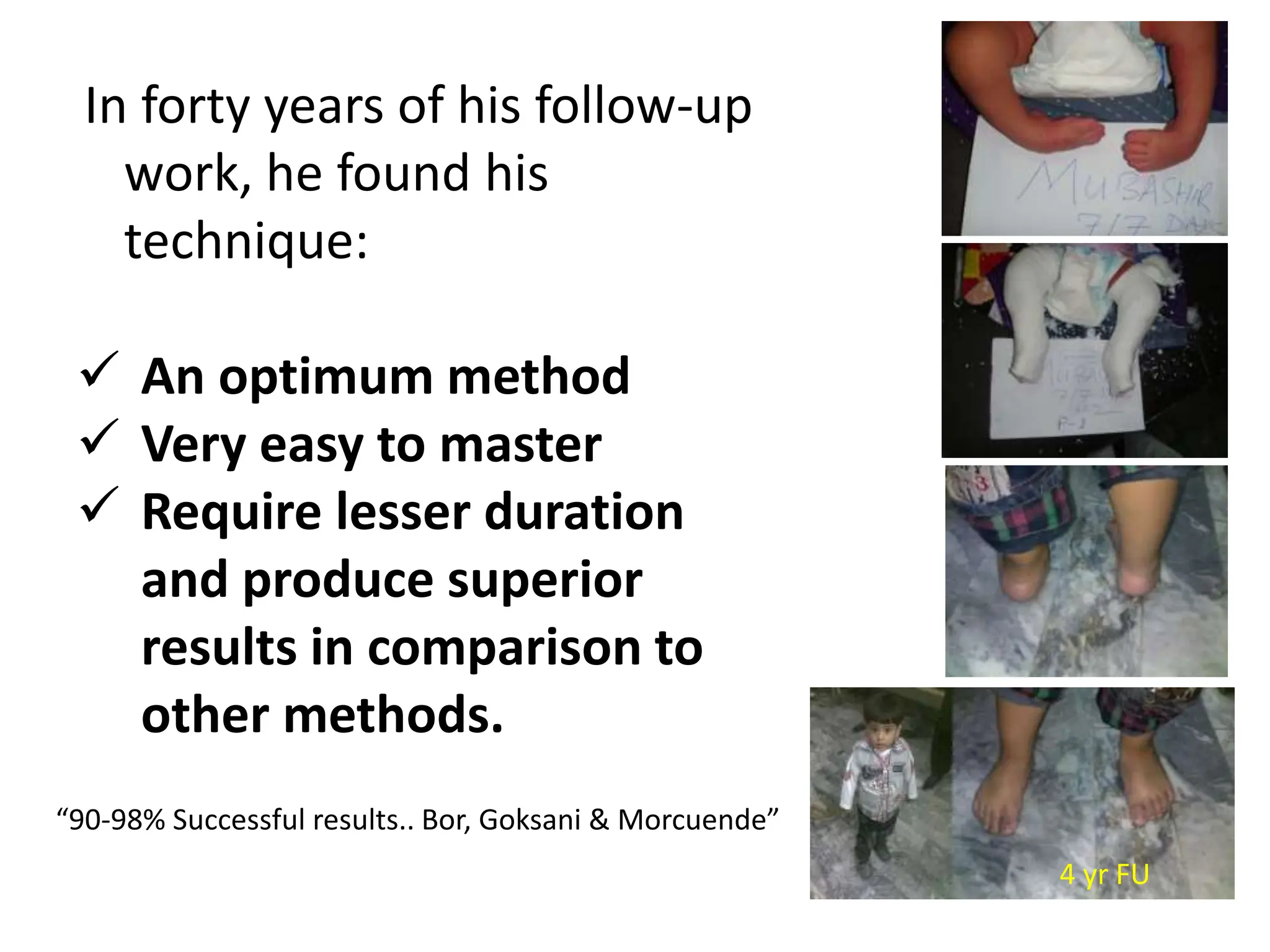 Why Ponseti Technique in Clubfoot management MARCH 2022.pptx