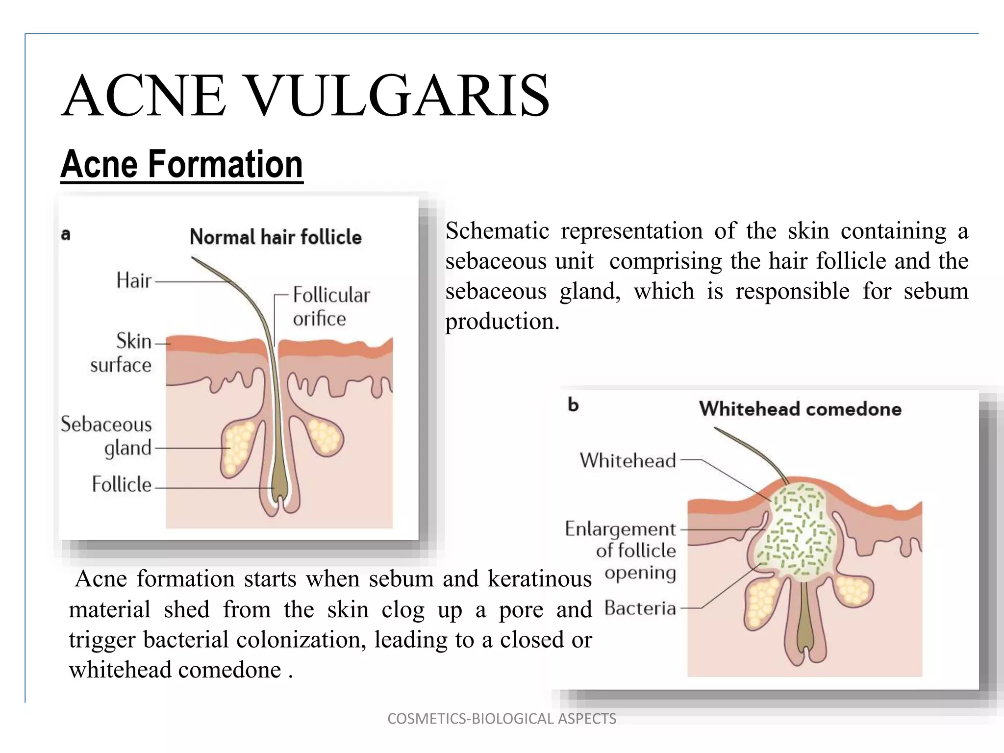 Structure of skin relating to the problem ACNE | PPTX