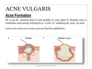 Structure of skin relating to the problem ACNE | PPTX