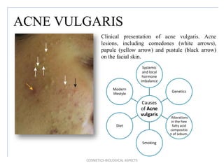 Structure of skin relating to the problem ACNE | PPTX