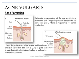 Structure of skin relating to the problem ACNE | PPTX