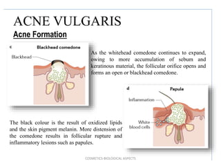 Structure of skin relating to the problem ACNE | PPTX