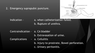 Acute Urinary Retention | PPTX