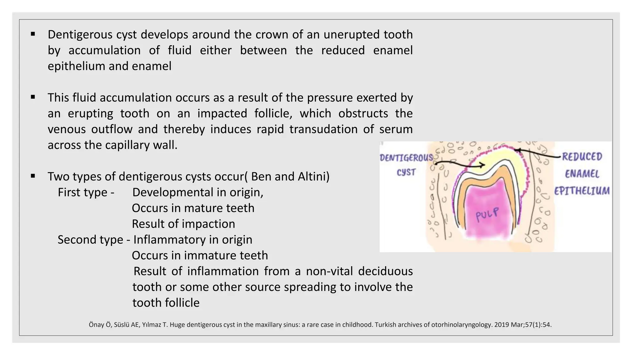 DENTIGEROUS CYST - a case presentation with review | PPTX