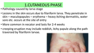 hookworm infection | PPTX