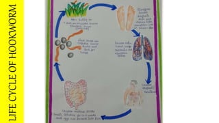 hookworm infection | PPTX