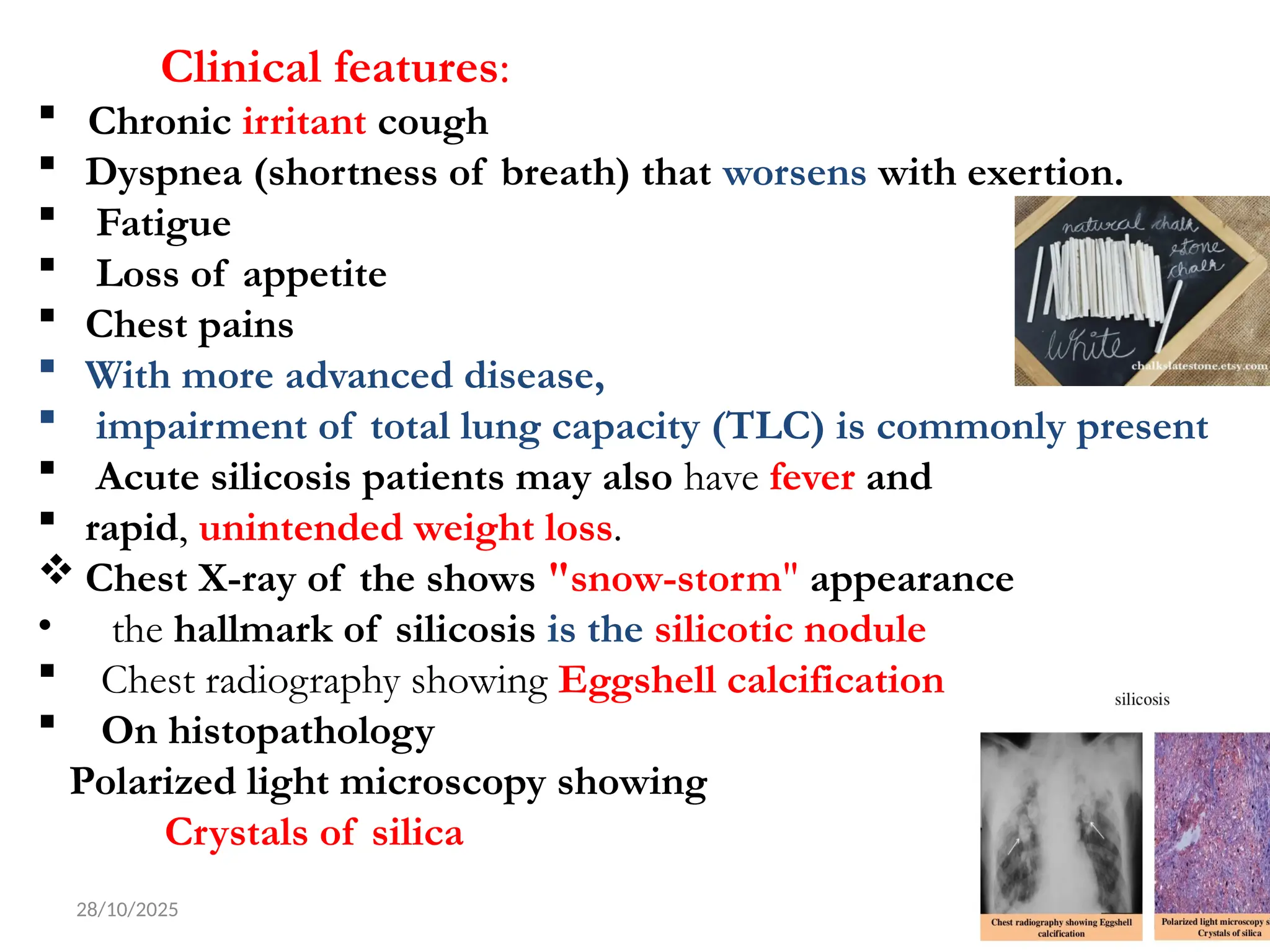 Silicosis causes serious lung damages .. | PPTX