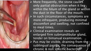 Sublingual Caruncle Swelling