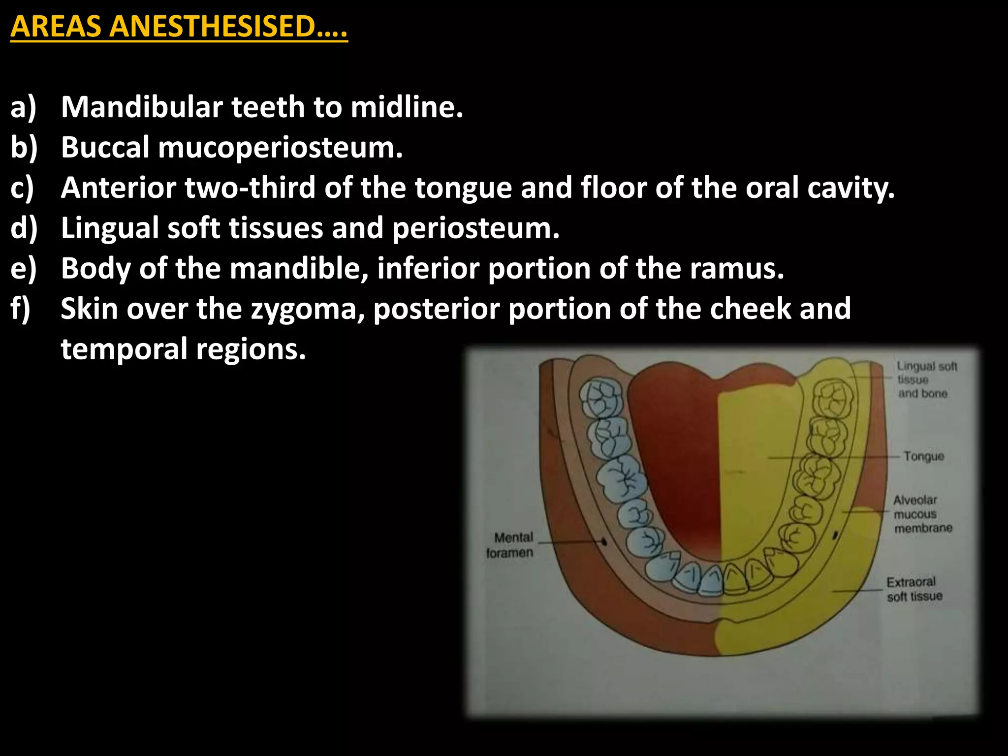 MANDIBULAR NERVE BLOCK. | PPTX