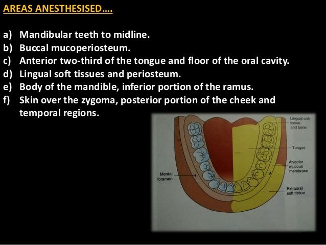 MANDIBULAR NERVE BLOCK.