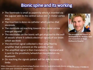 SPINAL CORD NOVEL TREATMENT | PPT