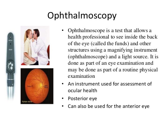 Ophthalmoscopy