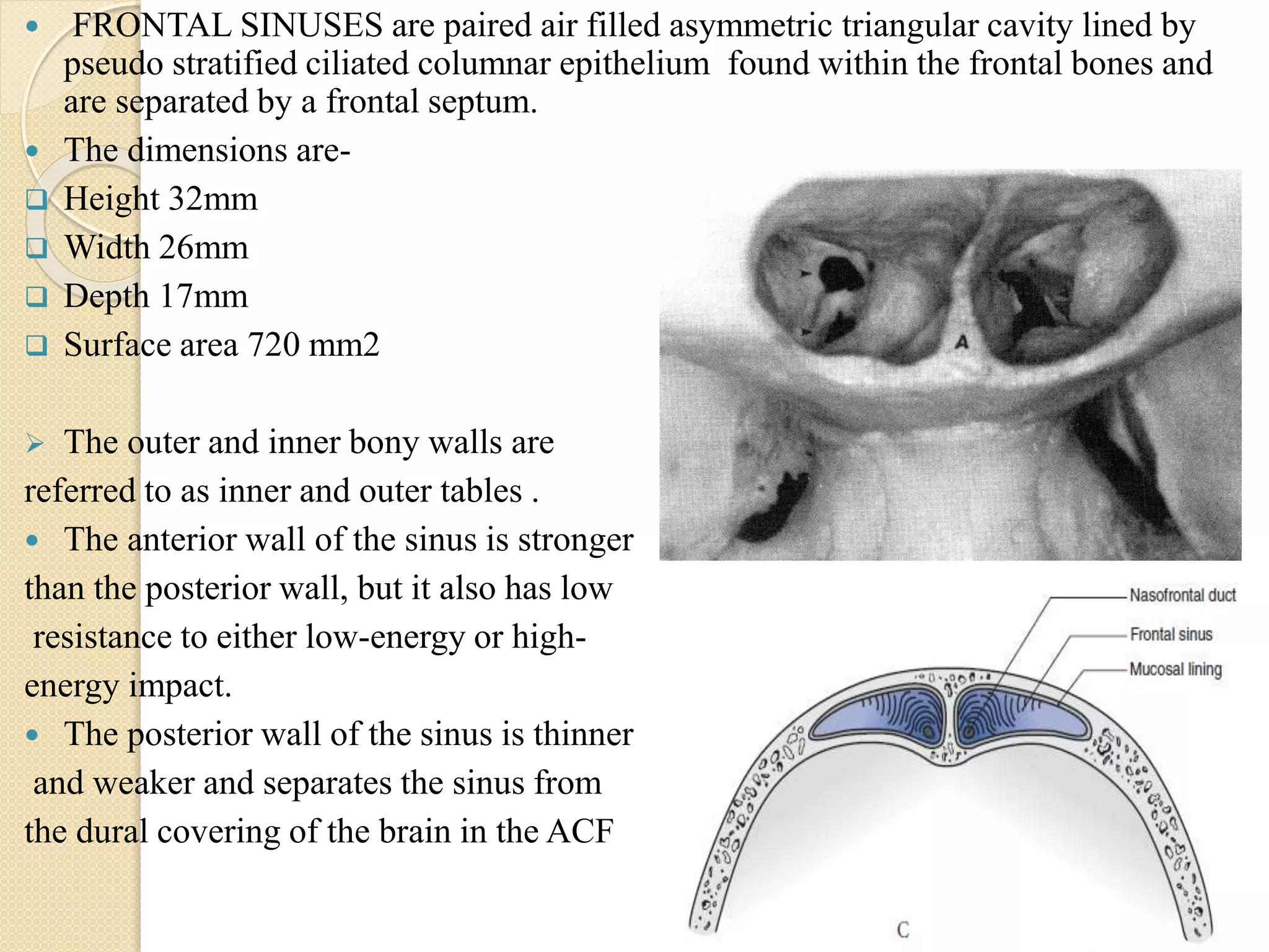 FRONTAL BONE FRACTURE | PPTX