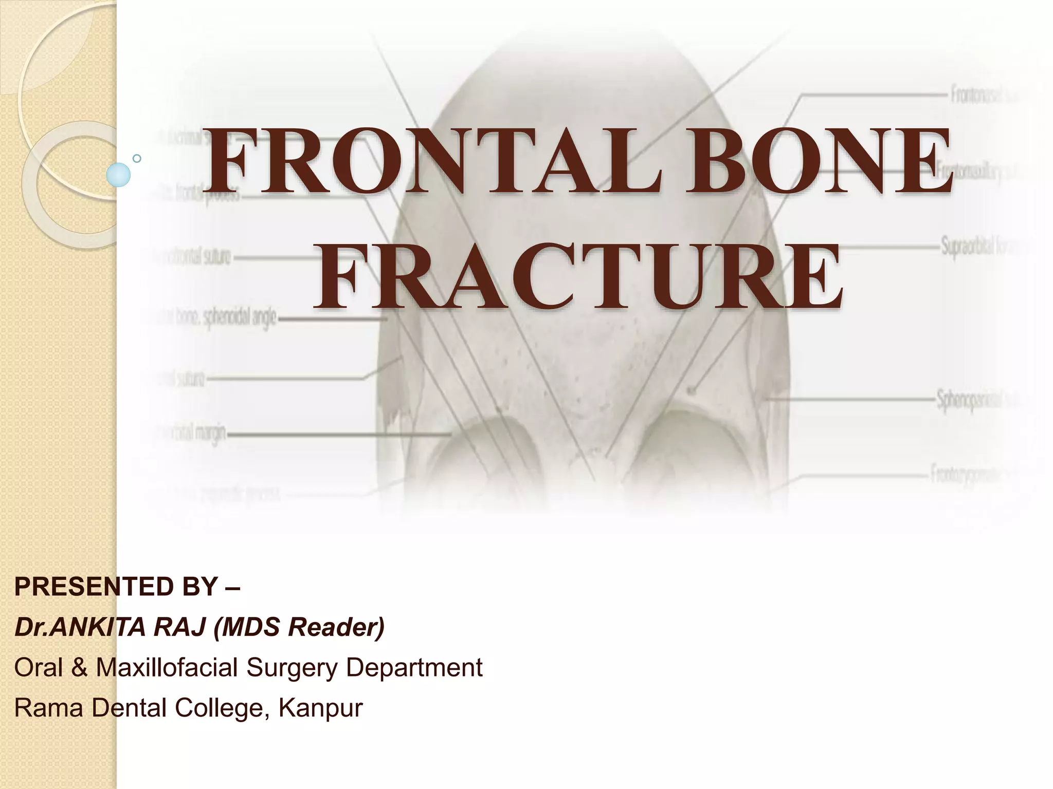 FRONTAL BONE FRACTURE | PPTX