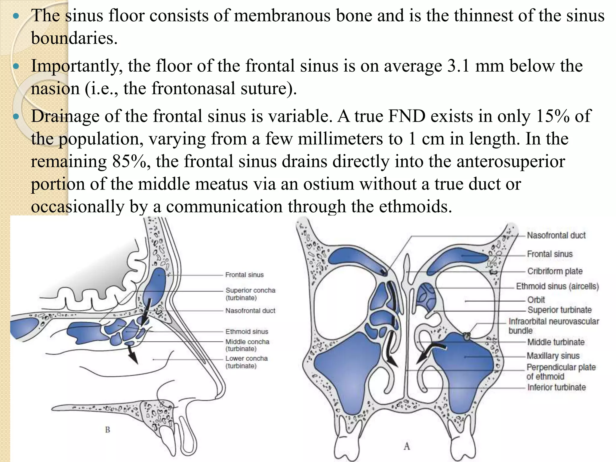 FRONTAL BONE FRACTURE | PPTX