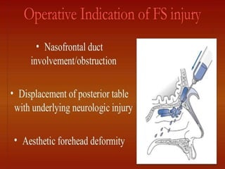 FRONTAL BONE FRACTURE | PPTX
