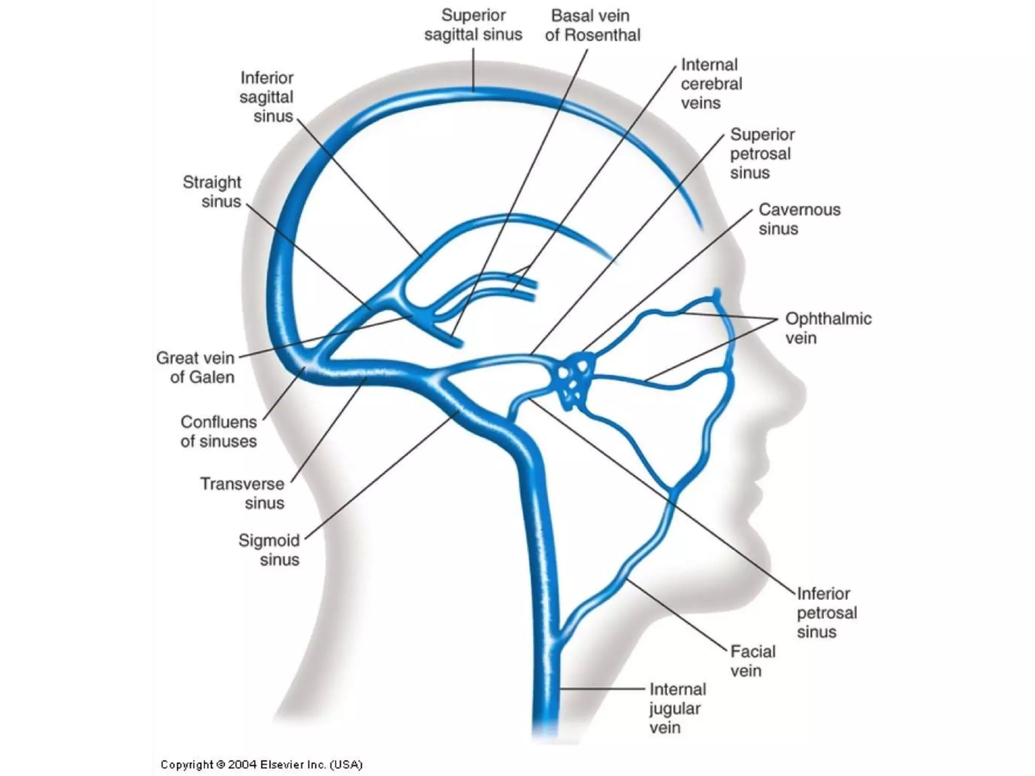CAVERNOUS SINUS THROMBOSIS | PPTX