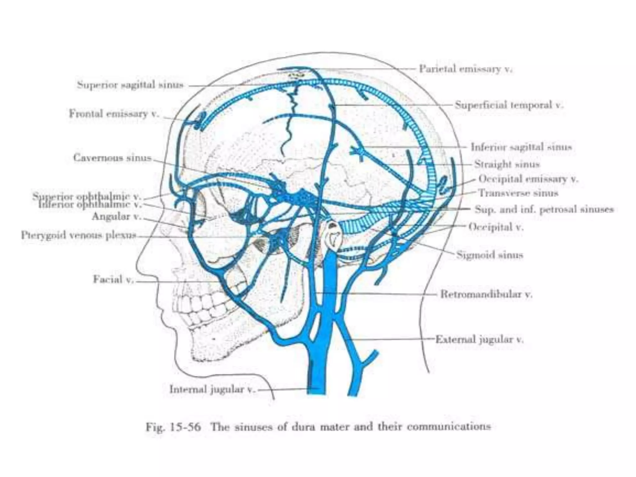 CAVERNOUS SINUS THROMBOSIS | PPTX
