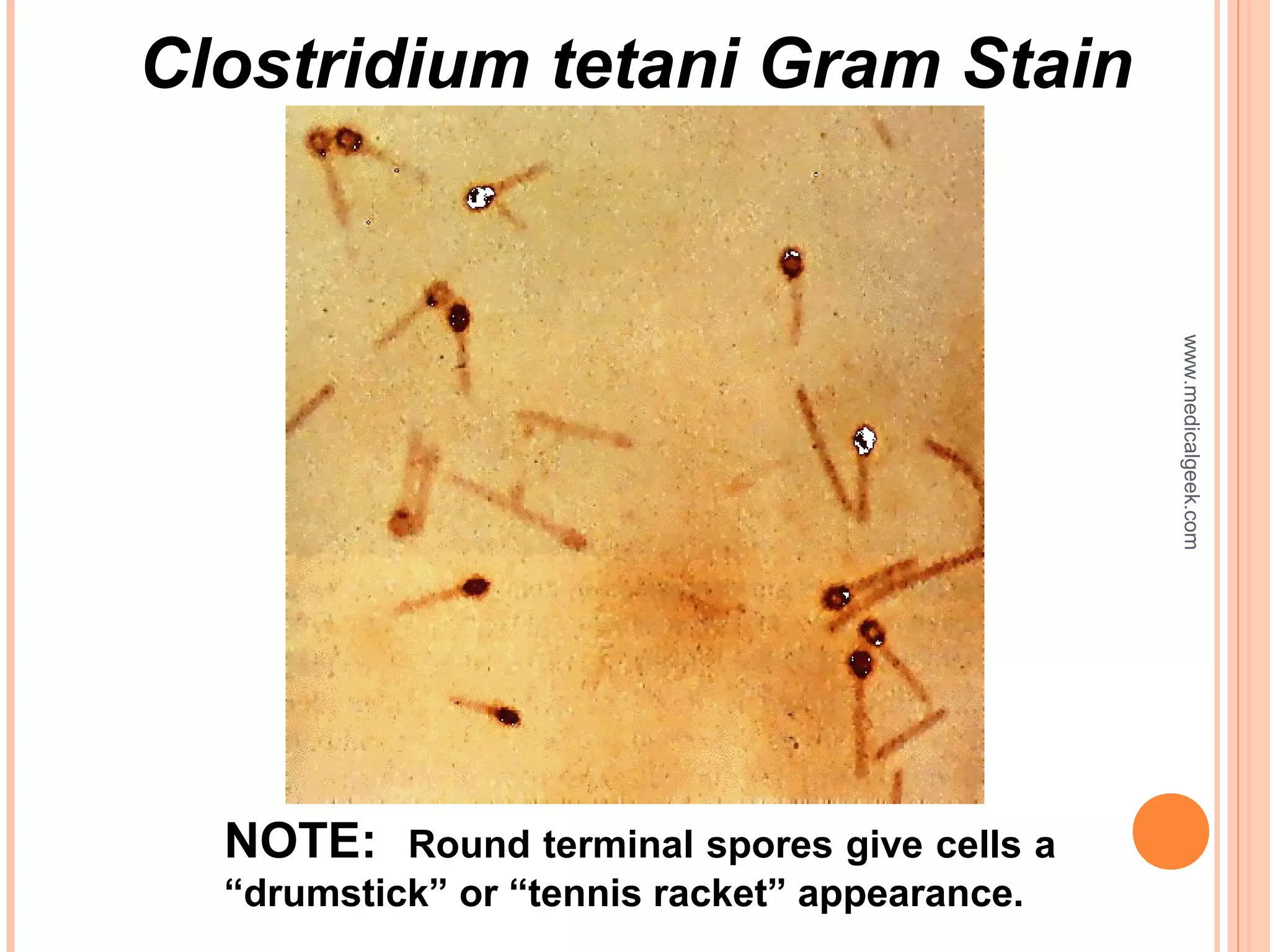 Tetanus Presentation | PPT