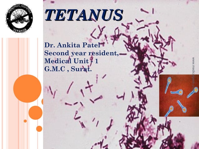 Tetanus Presentation | PPT