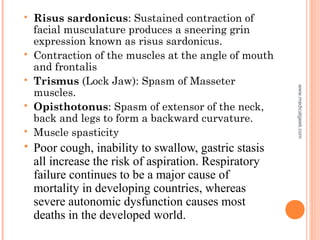 Tetanus Presentation | PPT