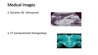 Medical Image Compression with security & water marking | PPTX ...