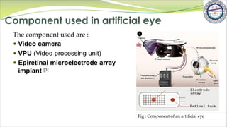 Artificial eye and its applications in daily life | PDF