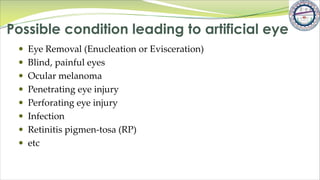 Artificial eye and its applications in daily life | PDF