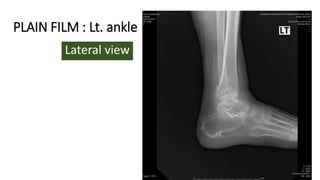 Ankle | PPT