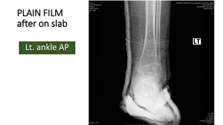 Ankle | PPT