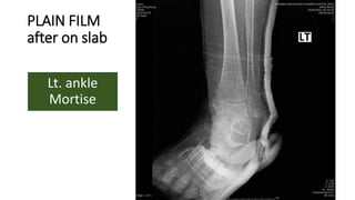 Ankle | PPT