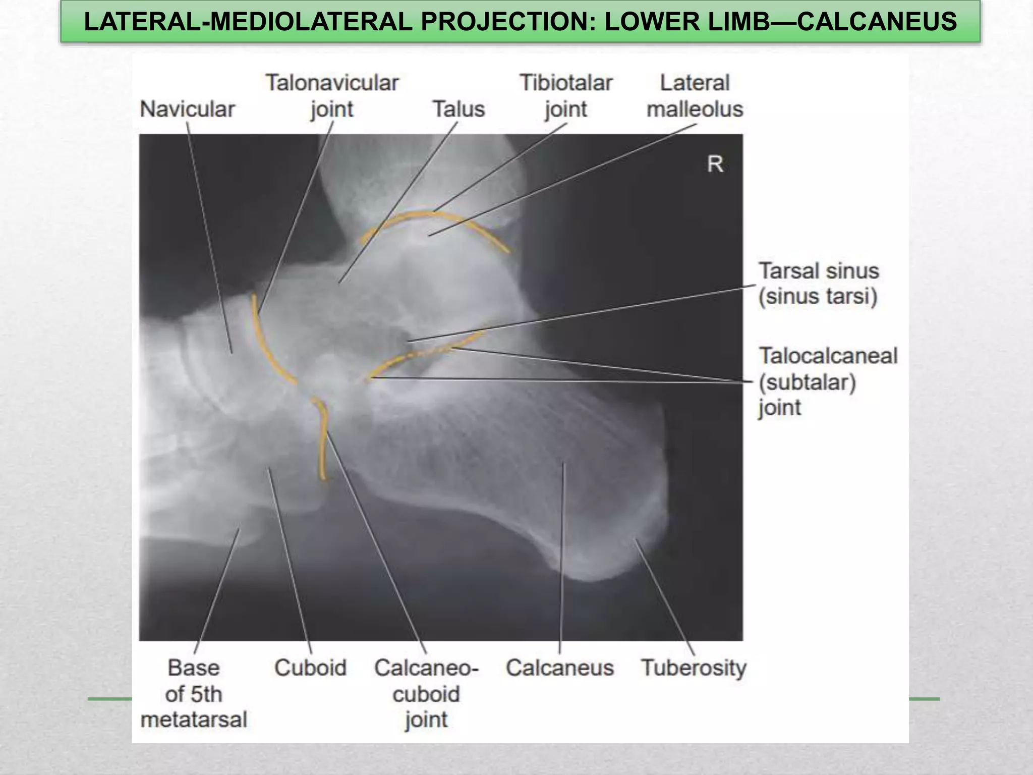 ankle.ppt