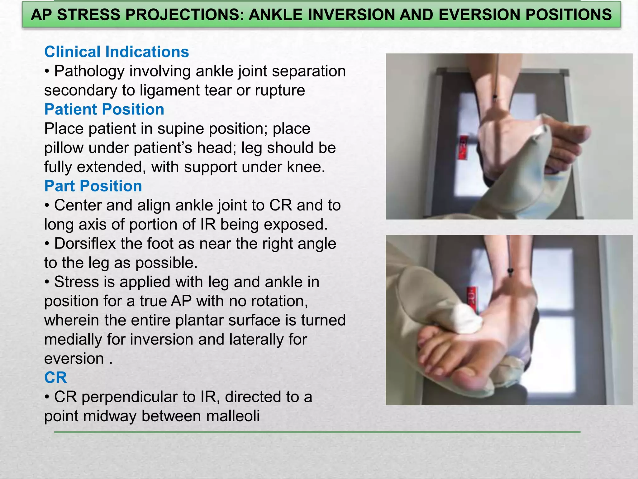 ankle.ppt