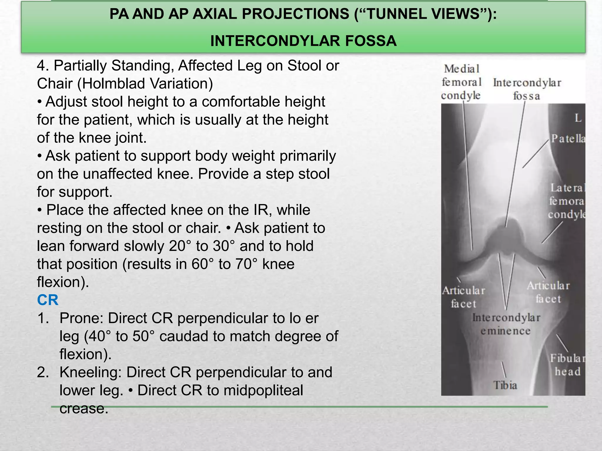 ankle.ppt