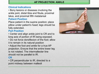 ankle.ppt
