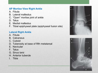 ankle.ppt