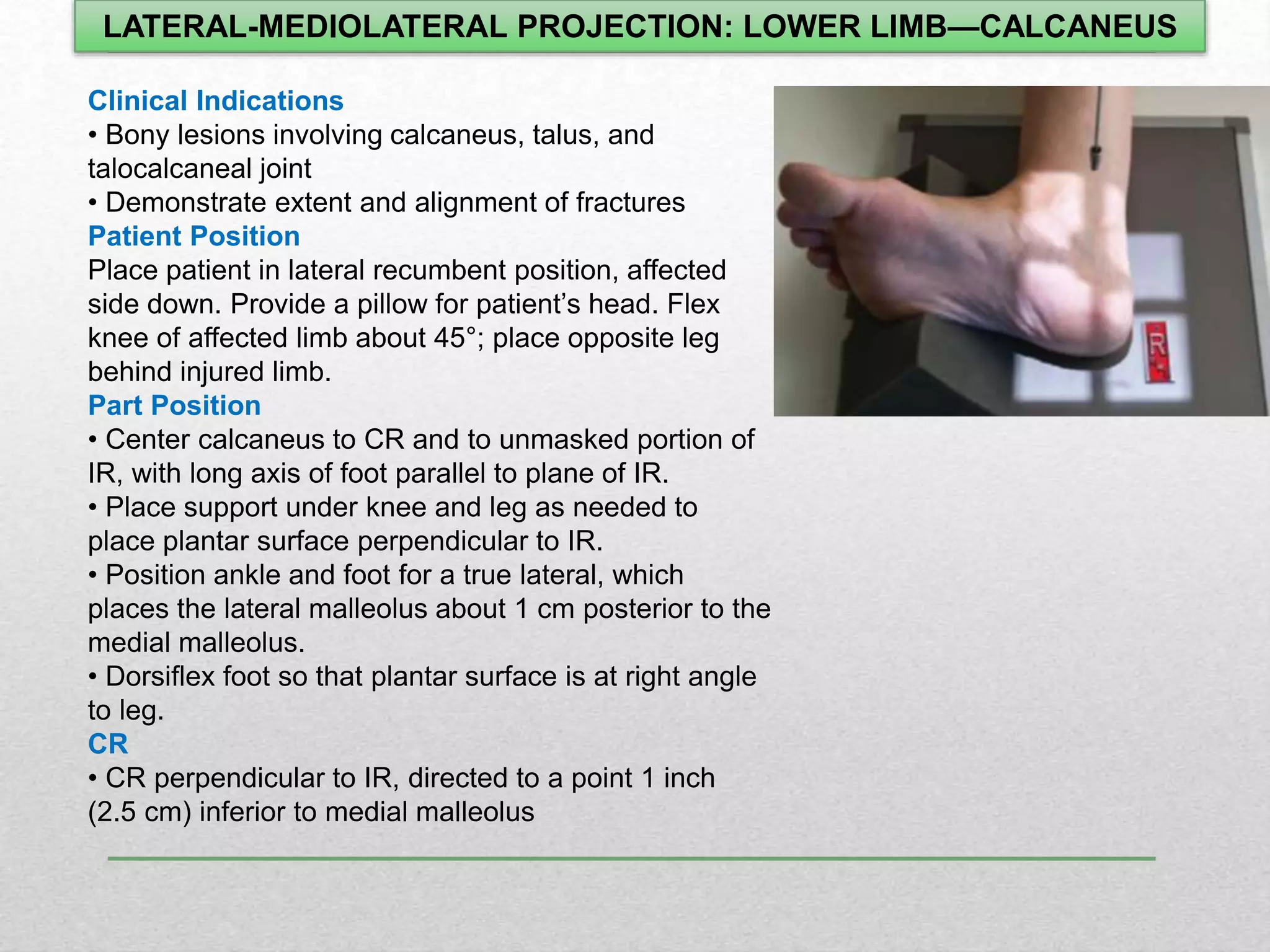 ankle.ppt