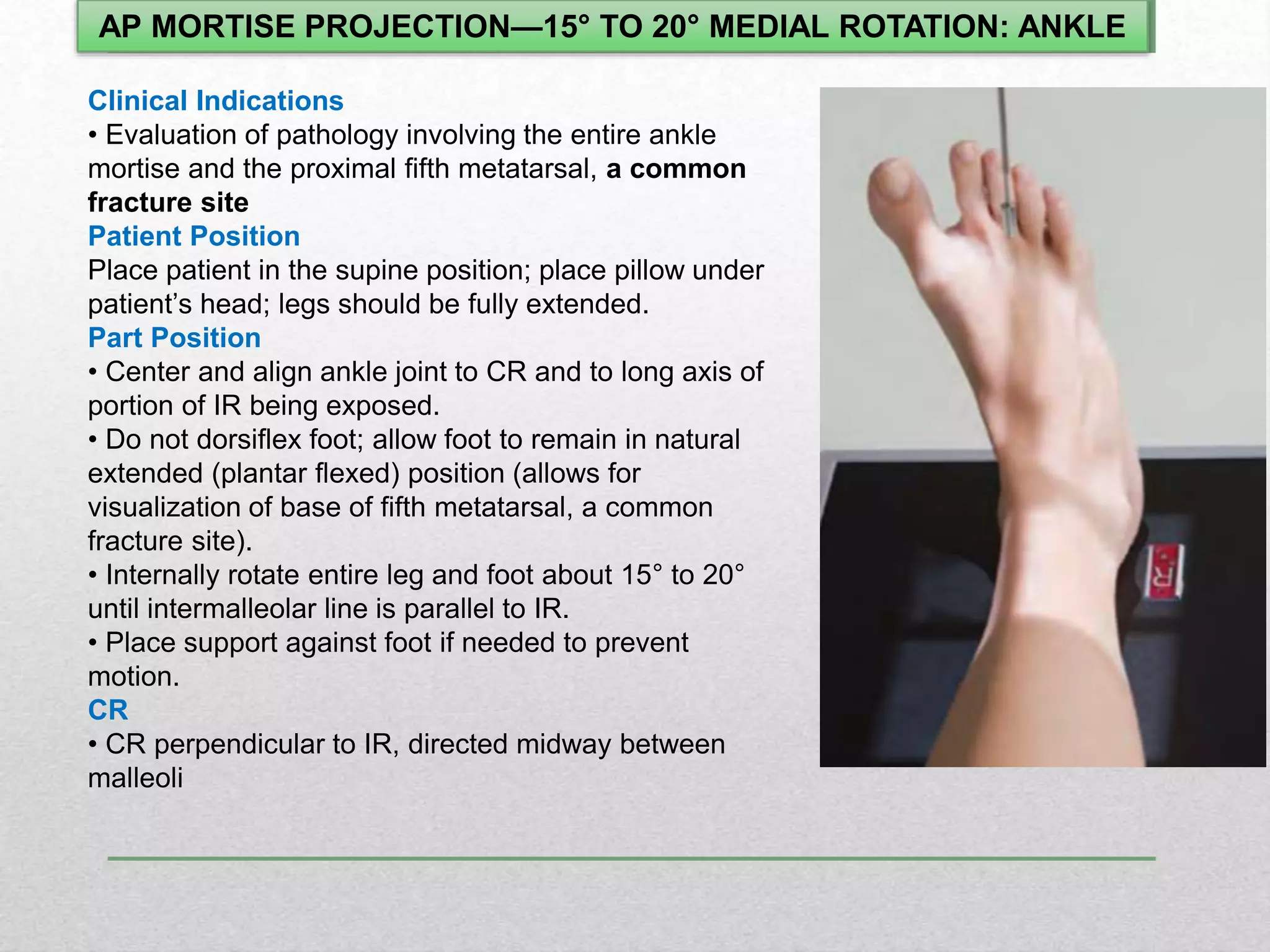 ankle.ppt
