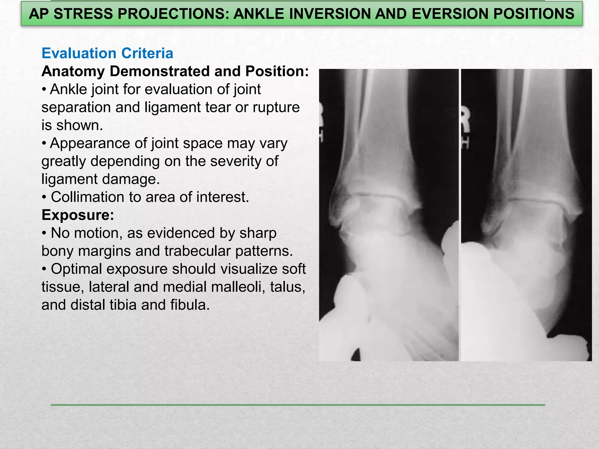 ankle.ppt