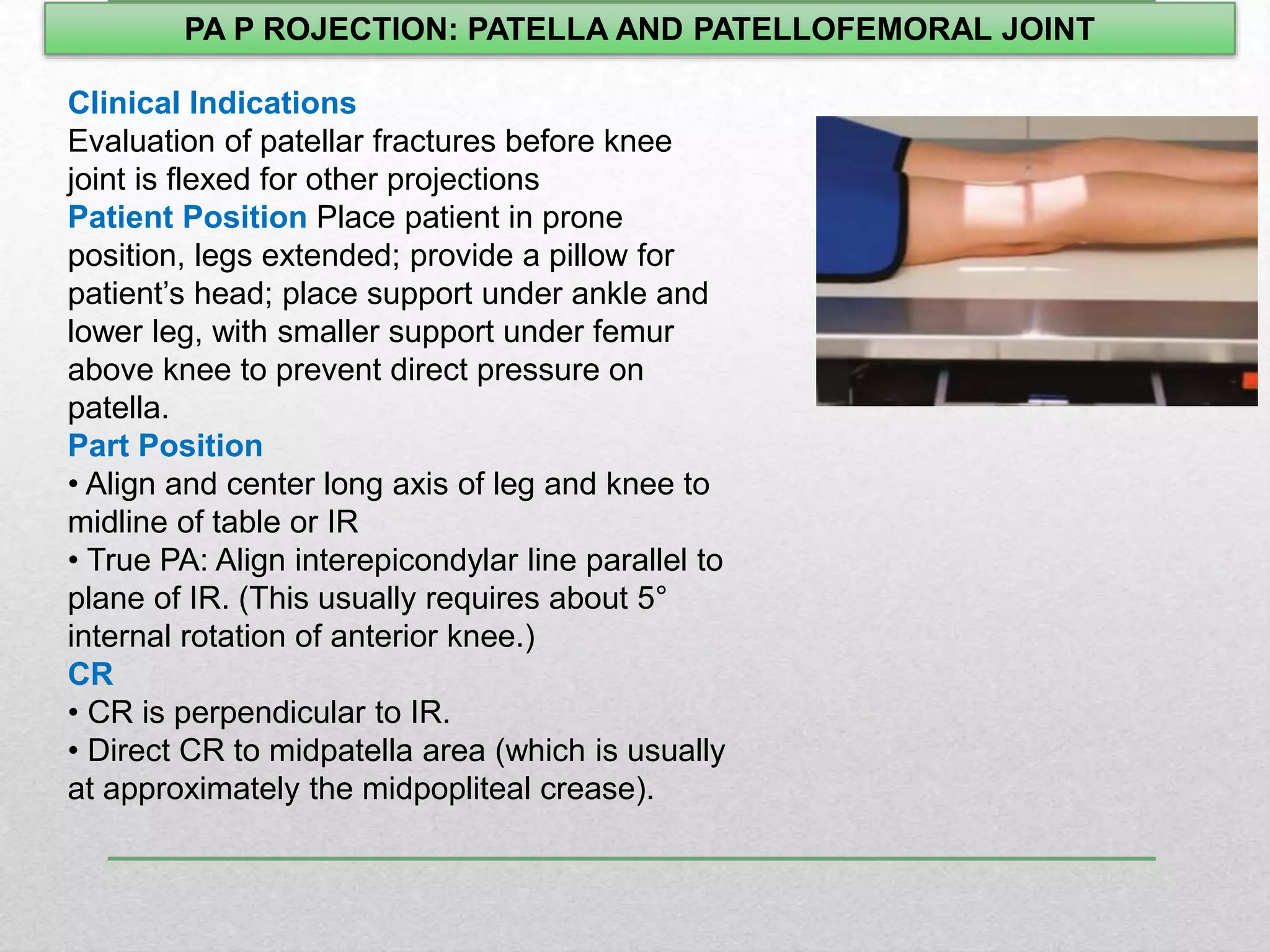 ankle.ppt