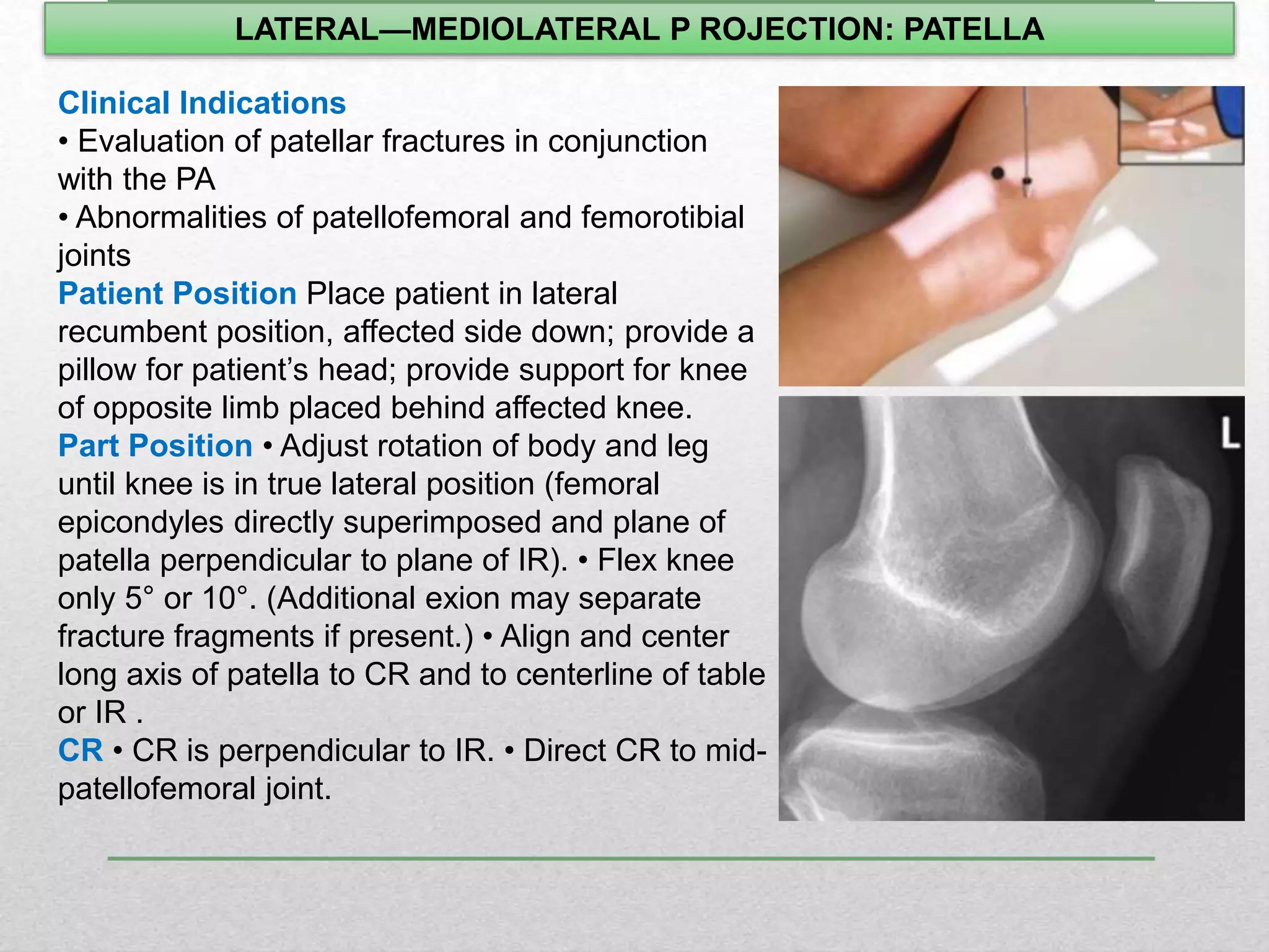 ankle.ppt