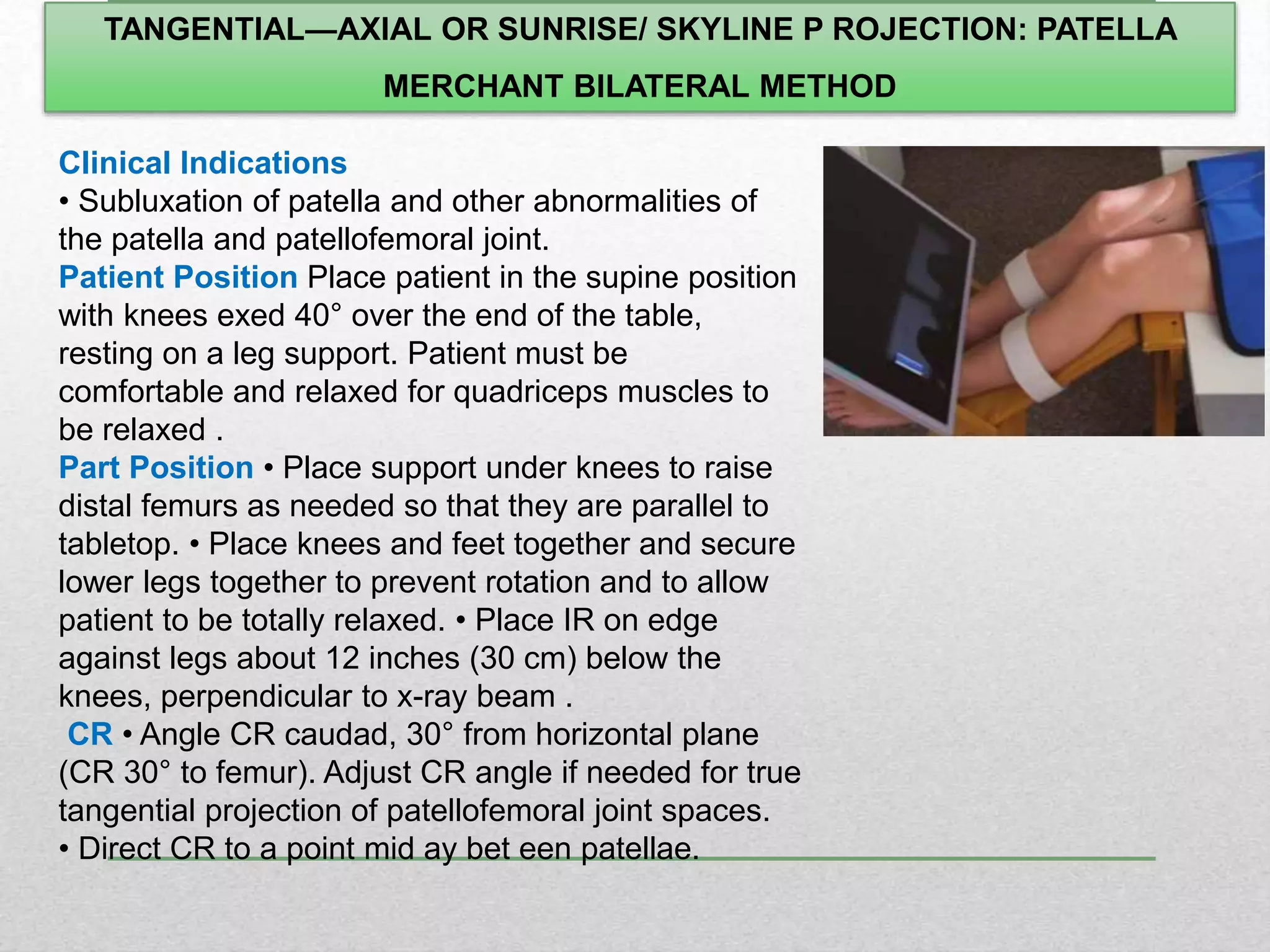 ankle.ppt