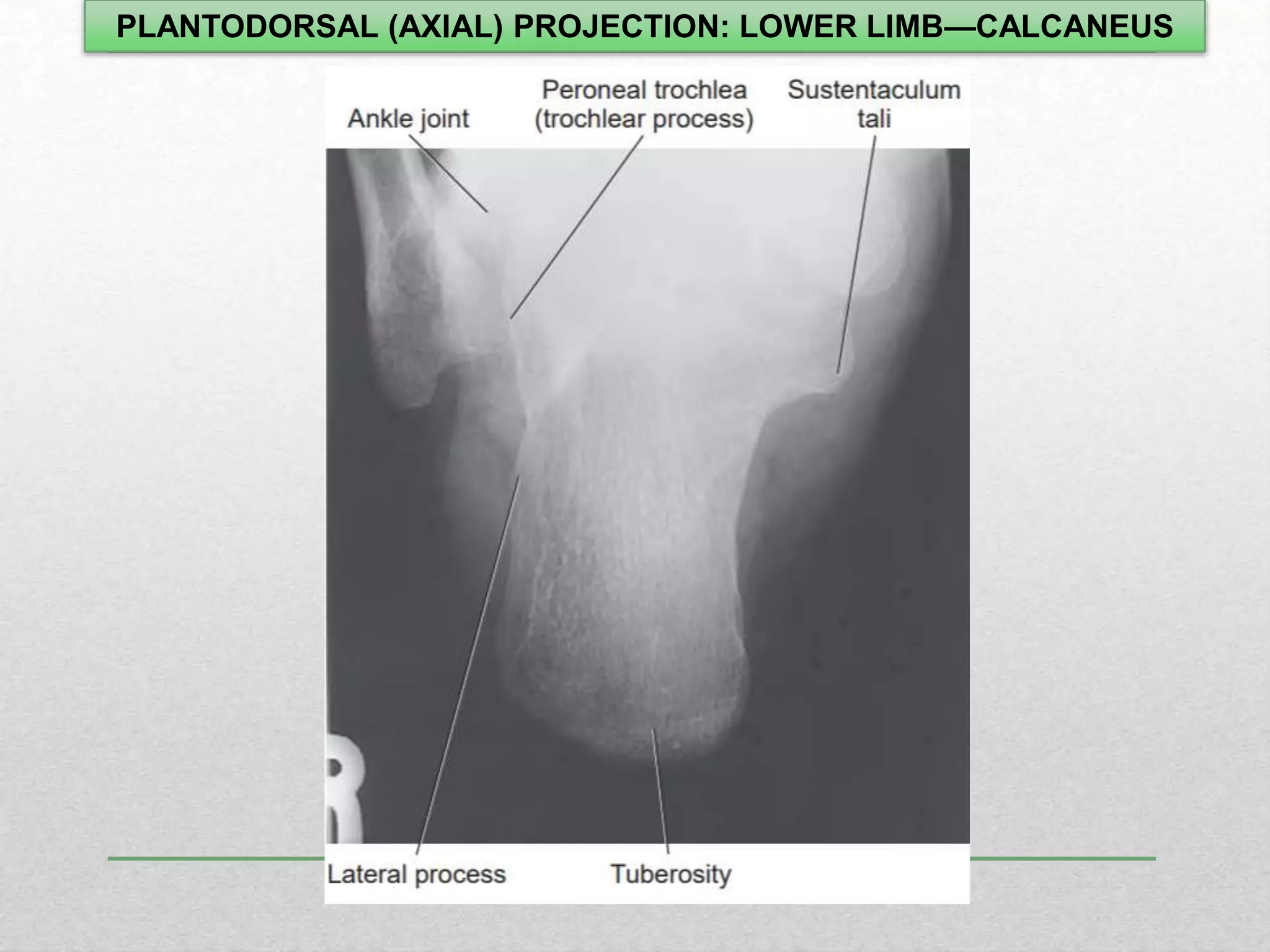 ankle.ppt