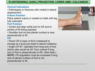 ankle.ppt