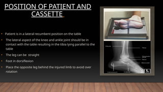 ANKLE radiographic procedure and positioning .pptx