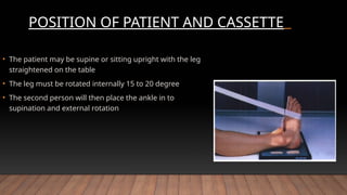 ANKLE radiographic procedure and positioning .pptx