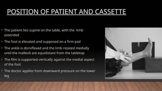 ANKLE radiographic procedure and positioning .pptx