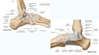 Ankle fracture | PDF