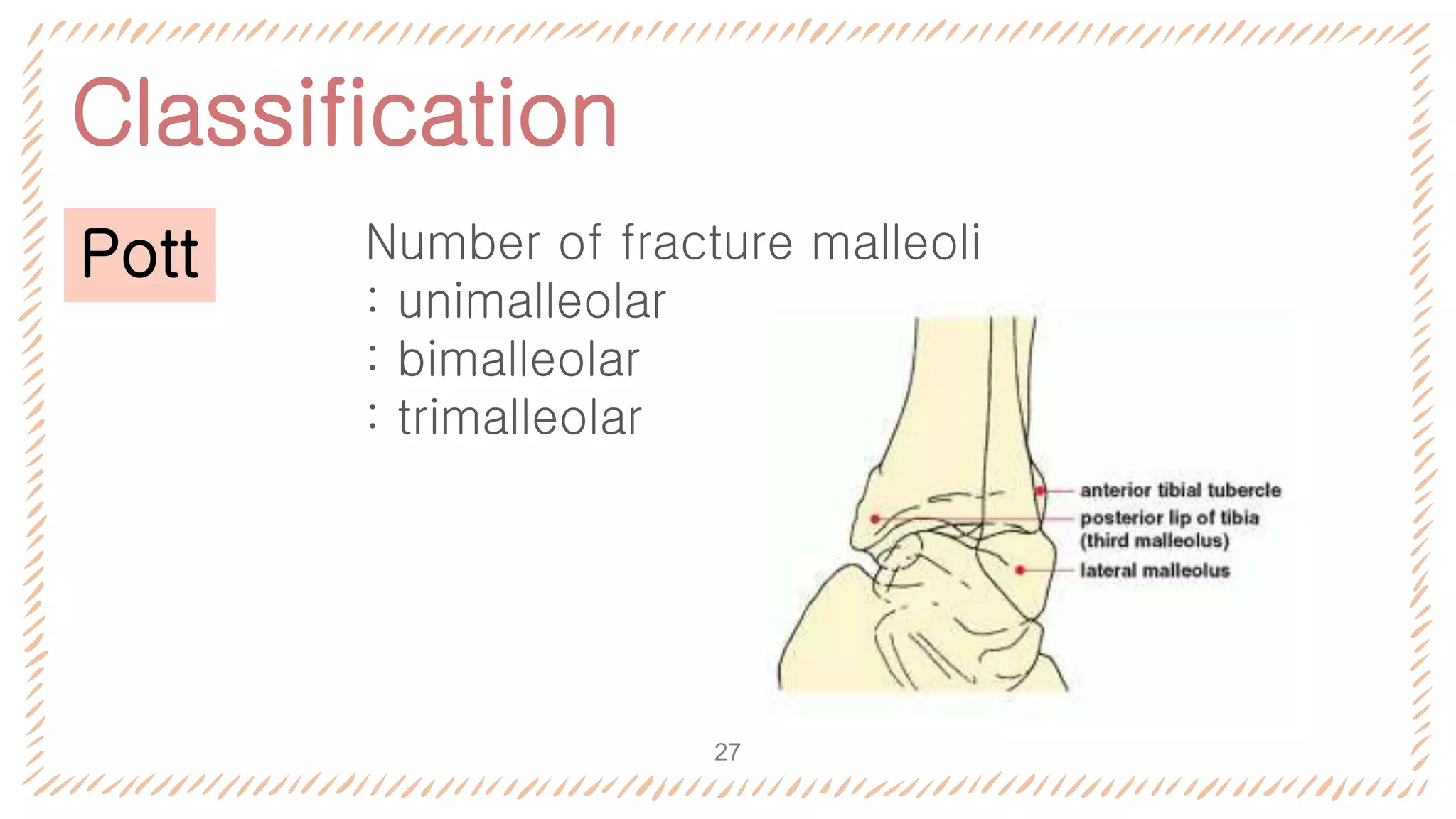 Ankle fracture-by-rgjel | PPTX